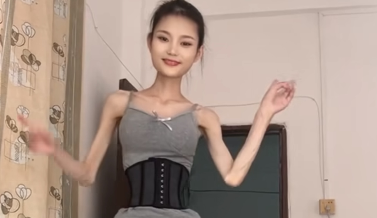 Influenciadora Chinesa que pesa só 25 Kg viraliza com corpo esquelético ...